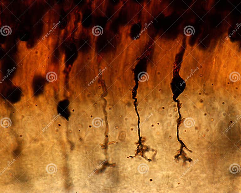 Retina. Golgi Method. Bipolar Cells Stock Image - Image of microscope ...