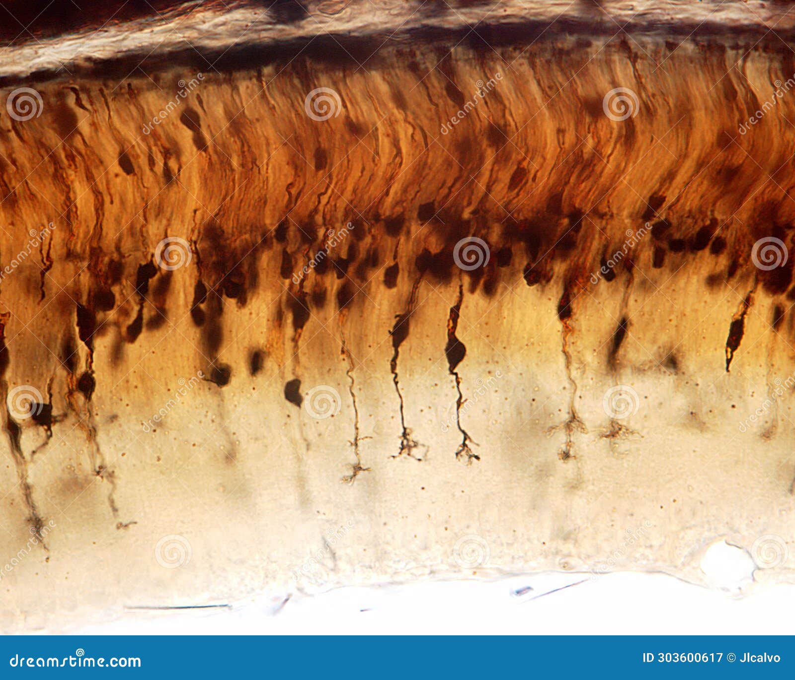 Retina. Golgi Method. Bipolar Cells Stock Image - Image of plexiform ...