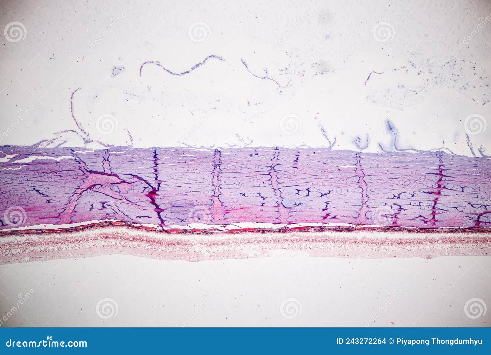 Retina Human Under Microscope. Stock Photo - Image of eyeball, healthy ...
