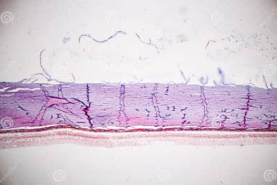 Retina Human Under Microscope. Stock Photo - Image of eyeball, healthy ...