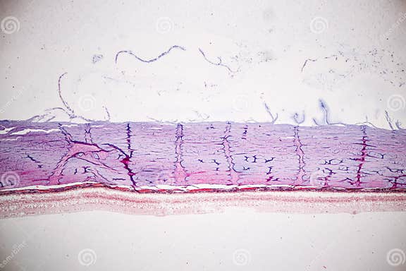 Retina Human Under Microscope. Stock Photo - Image of eyeball, healthy ...