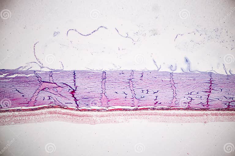 Retina Human Under Microscope. Stock Photo - Image of eyeball, healthy ...