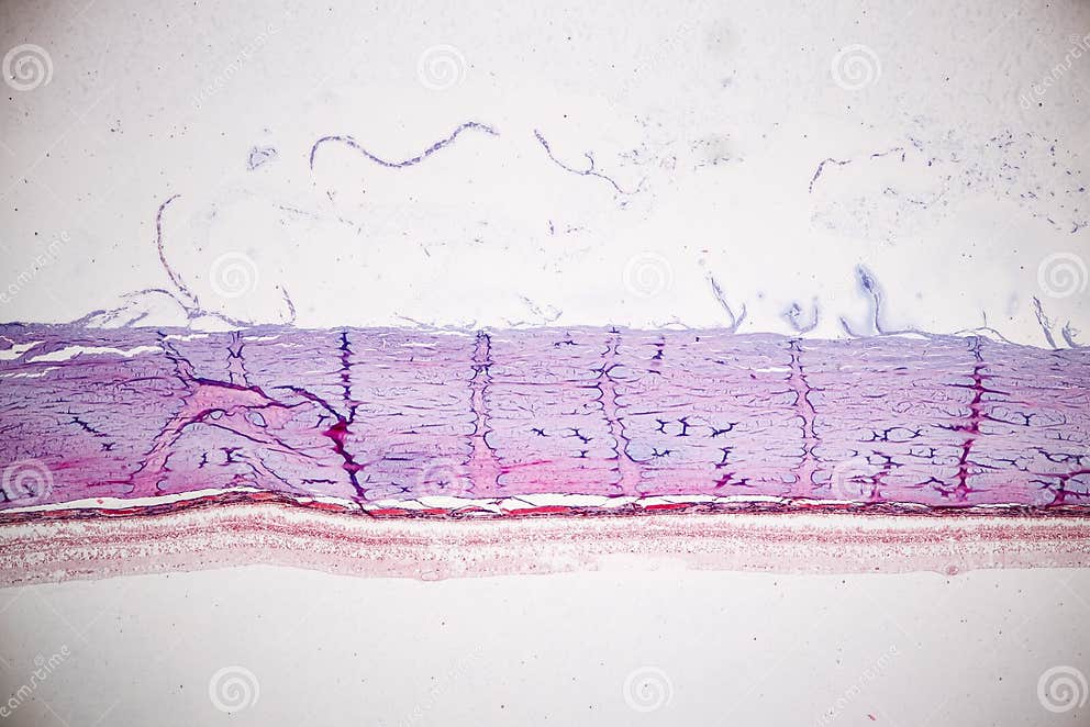Retina Human Under Microscope. Stock Photo - Image of eyeball, healthy ...