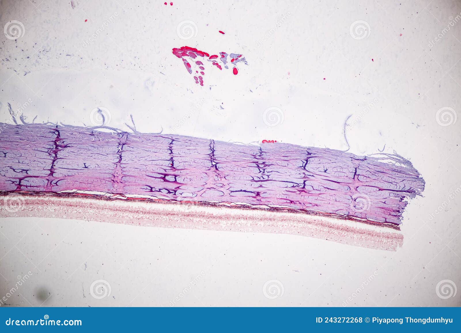 Retina Human Under Microscope. Stock Photo - Image of microscope ...