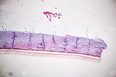 Retina Human Under Microscope. Stock Photo - Image of microscope ...