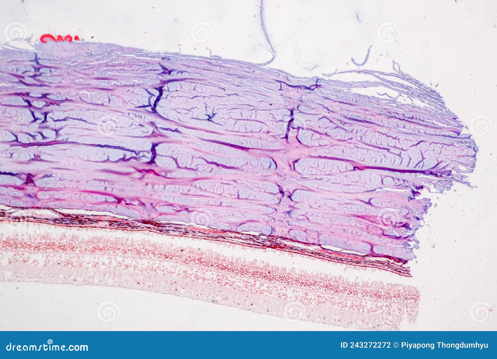 Retina Human Under Microscope. Stock Photo - Image of medicine, human ...