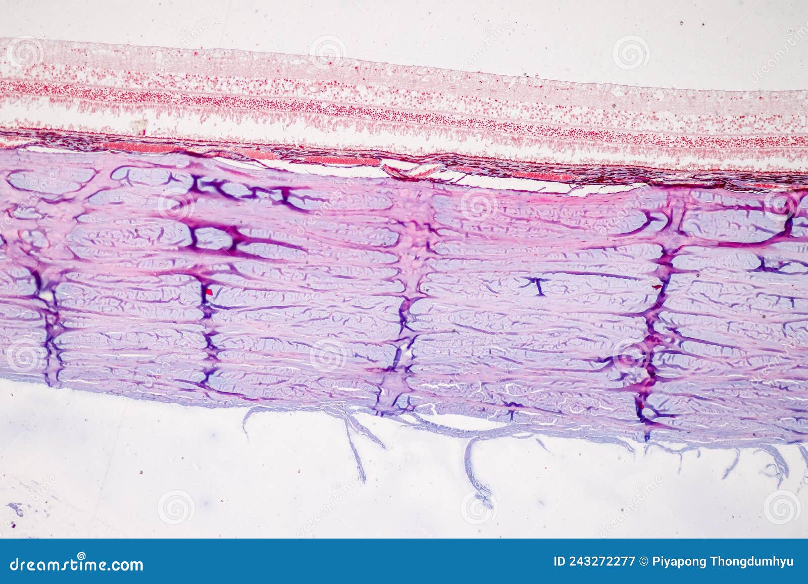 Retina Human Under Microscope. Stock Image - Image of medical, medicine ...