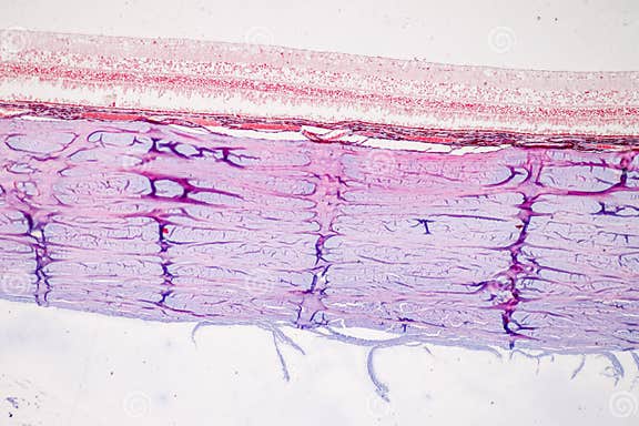 Retina Human Under Microscope. Stock Image - Image of medical, medicine ...