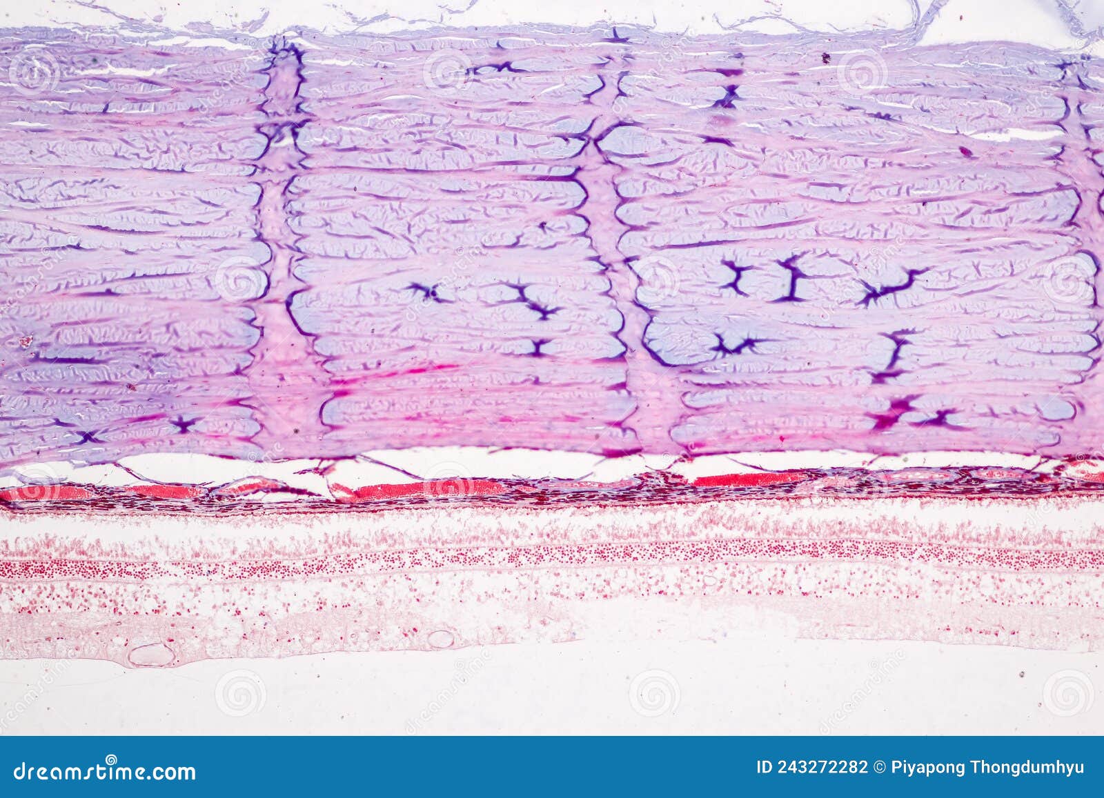 Retina Human Under Microscope. Stock Photo - Image of glaucoma, medical ...