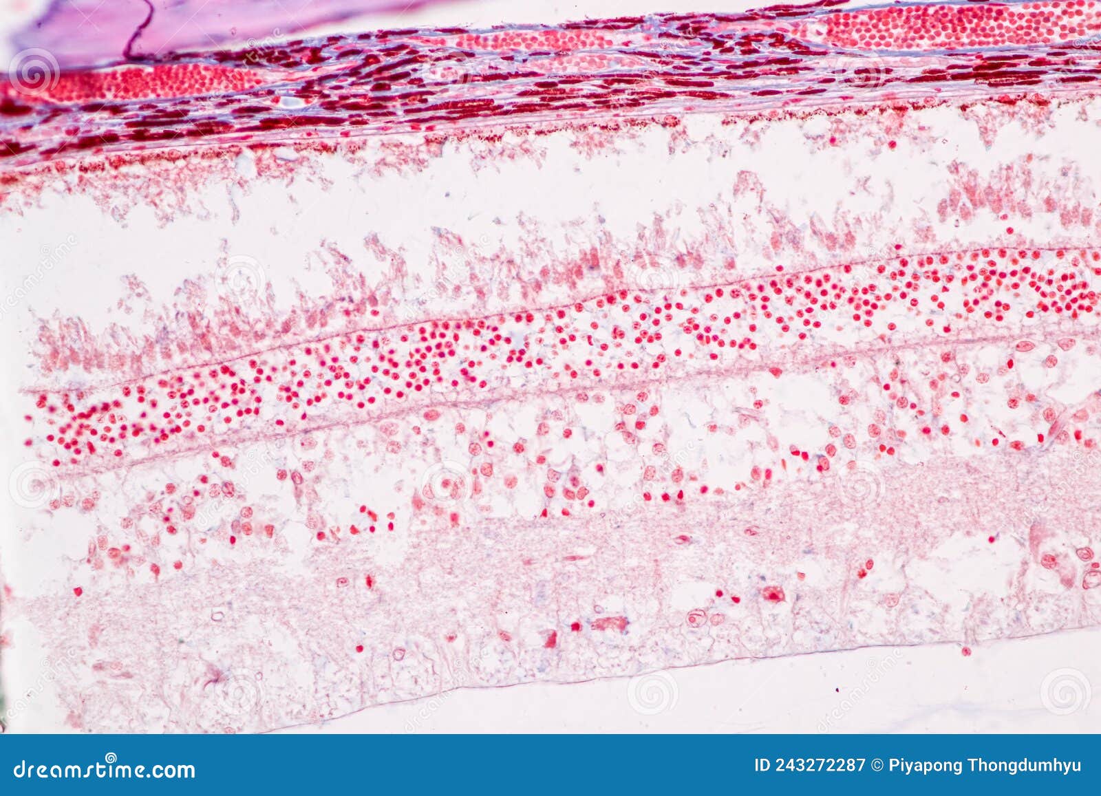 Retina In Human Eye Stock Image | CartoonDealer.com #26566945