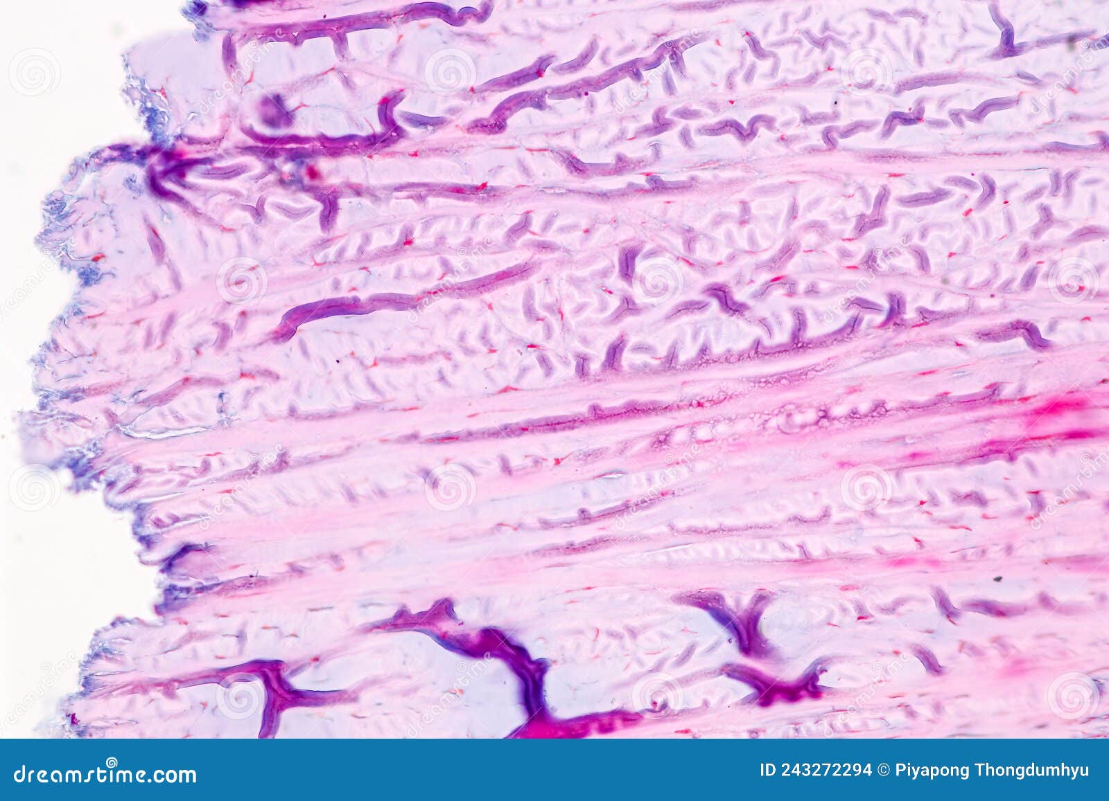 Retina Human Under Microscope. Stock Photo - Image of disease, lens ...
