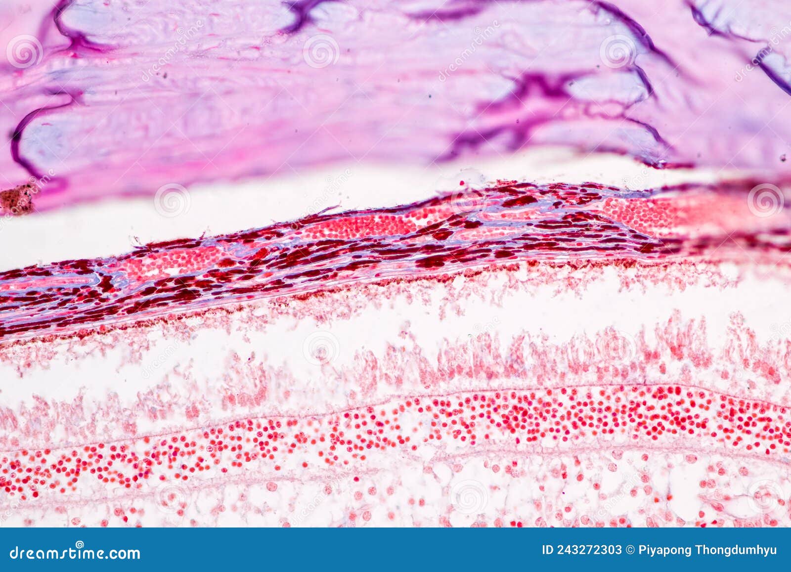 Retina Human Under Microscope. Stock Image - Image of muscle, lens ...