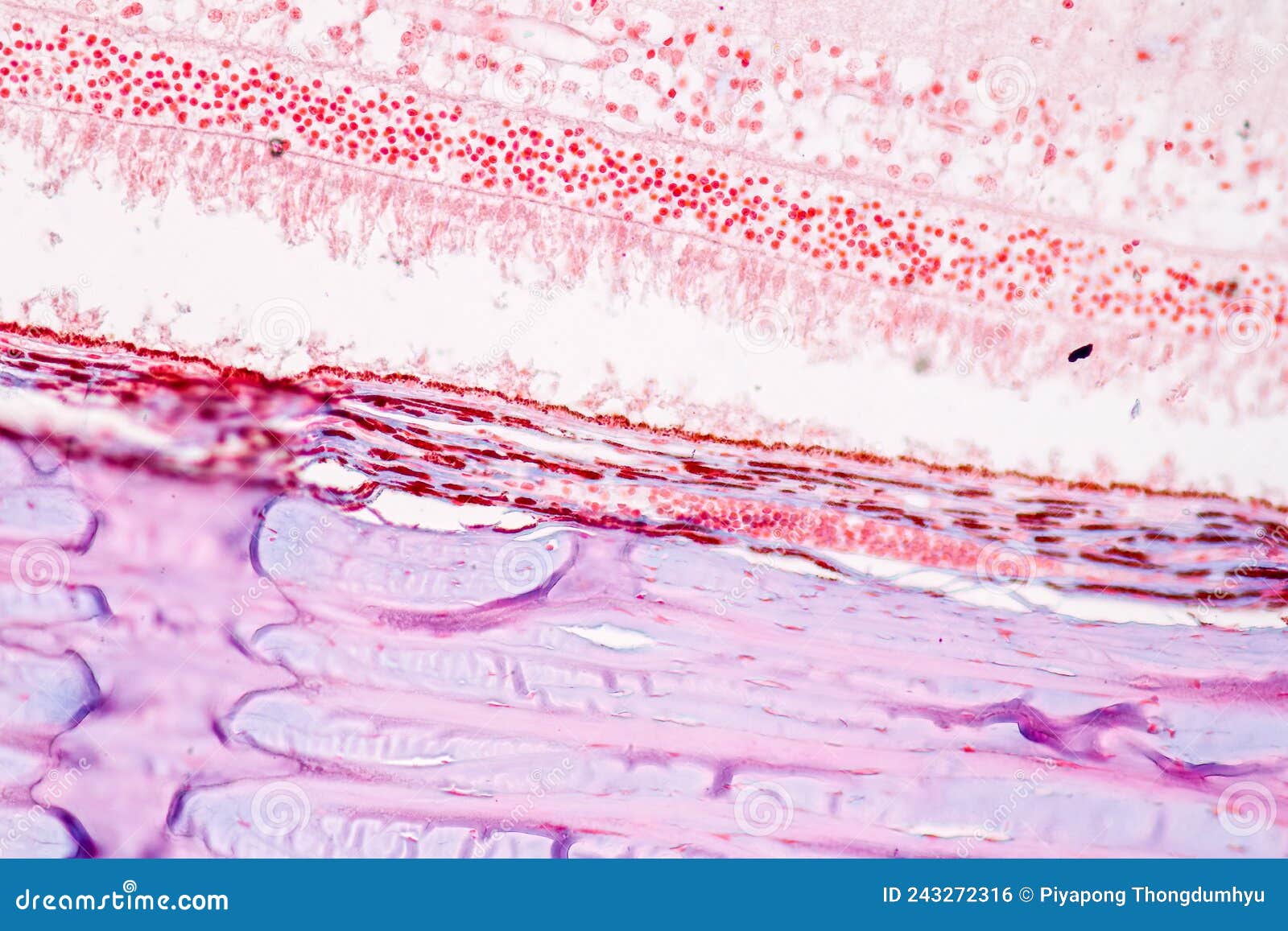 Retina Human Under Microscope. Stock Photo - Image of duct, eyeball ...