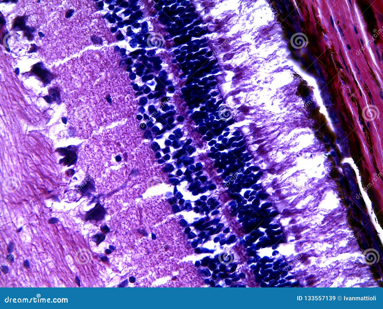 Retina Humana Sob O Microscópio Imagem de Stock - Imagem de gânglio ...