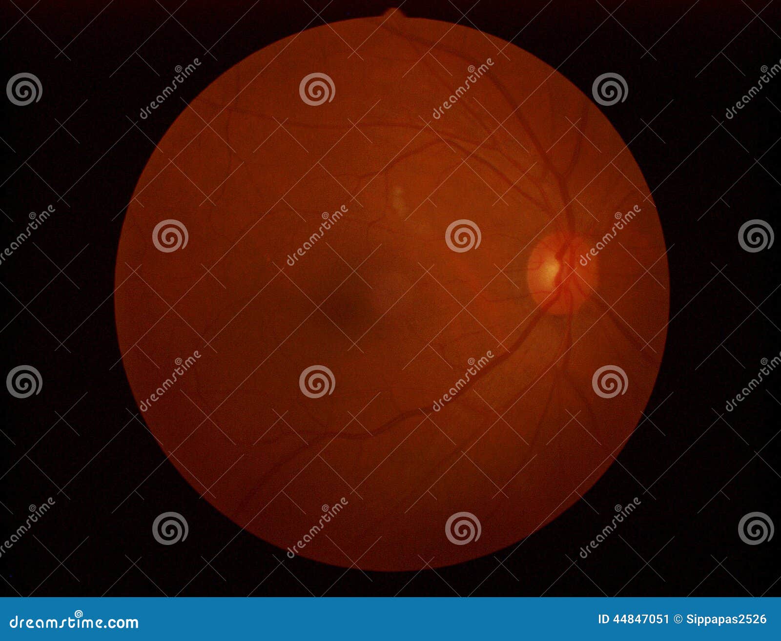 The Retina stock image. Image of ophthalmologist, healthcare - 44847051