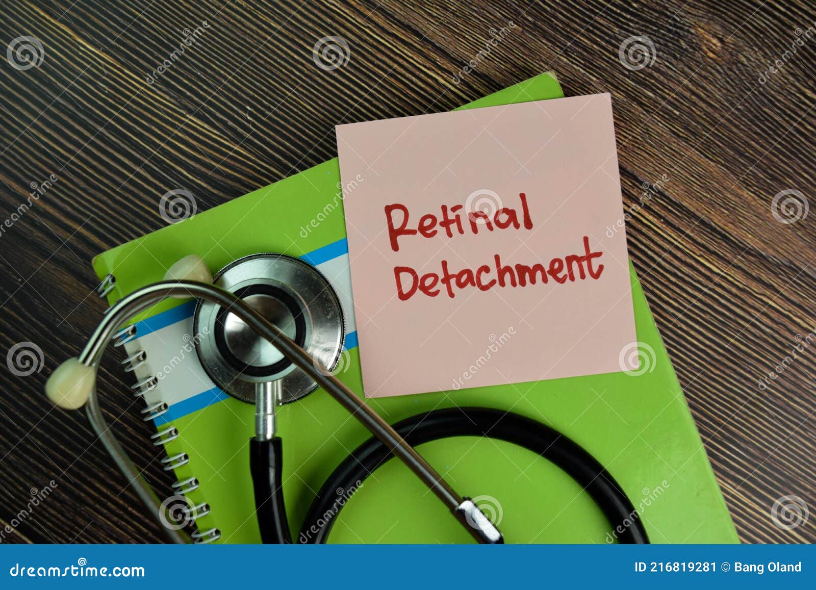 Retinal Detachment. Text Label To Indicate The State Of Health. Royalty ...