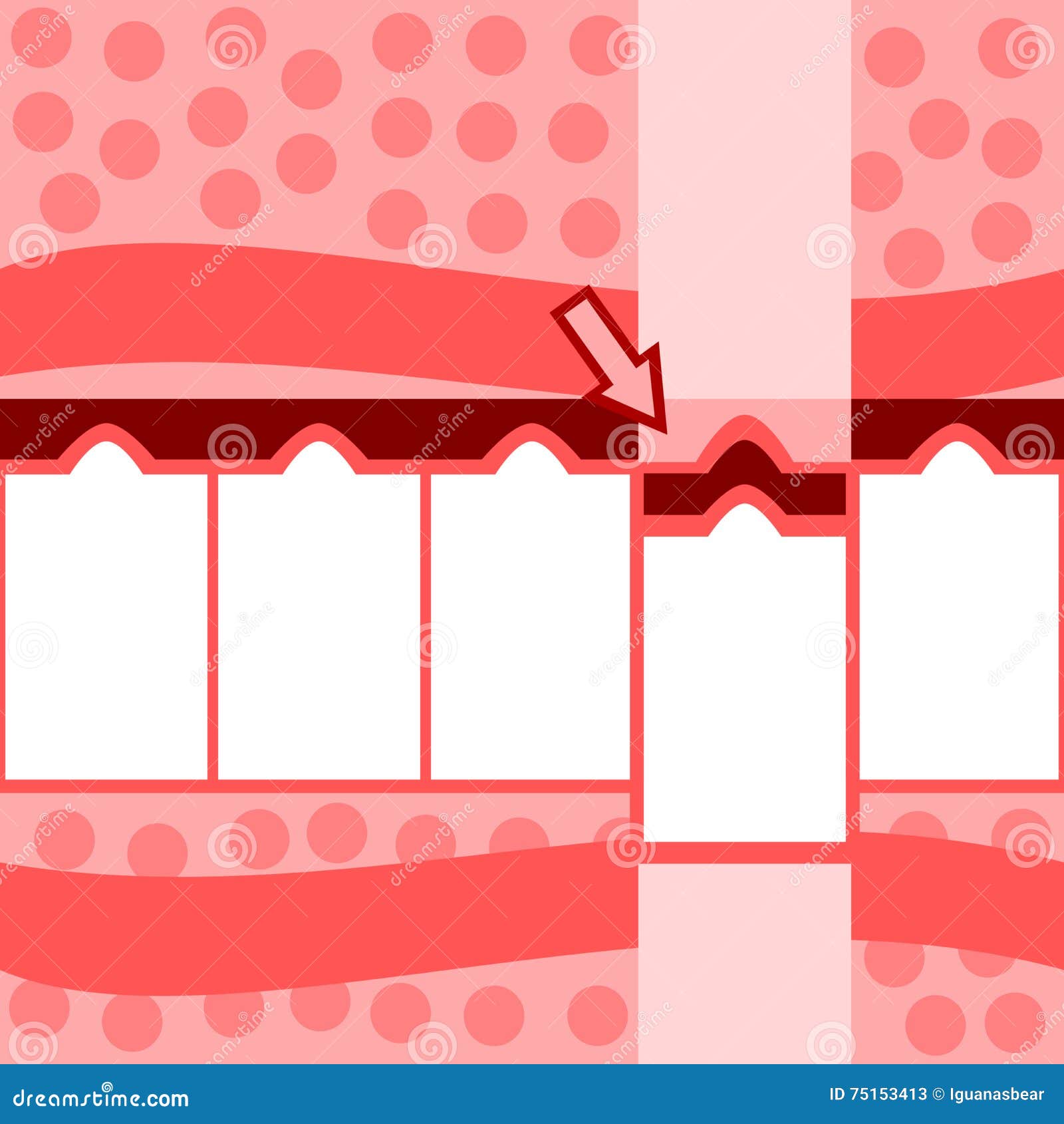 Retro Stylized Red Pink White Five Steps Info Graphic Stock Vector ...