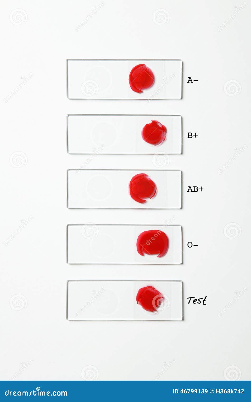 RH Blood Test Isolated on White Stock Image - Image of human, virus ...