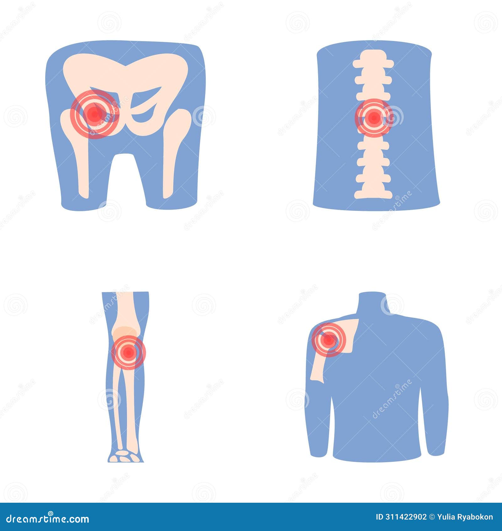 Rheumatism Icons Set Cartoon Vector. Human Joint with Pain Ring Stock ... Rheumatism Icons Set Cartoon Vector. Human Joint with Pain Ring Stock ...