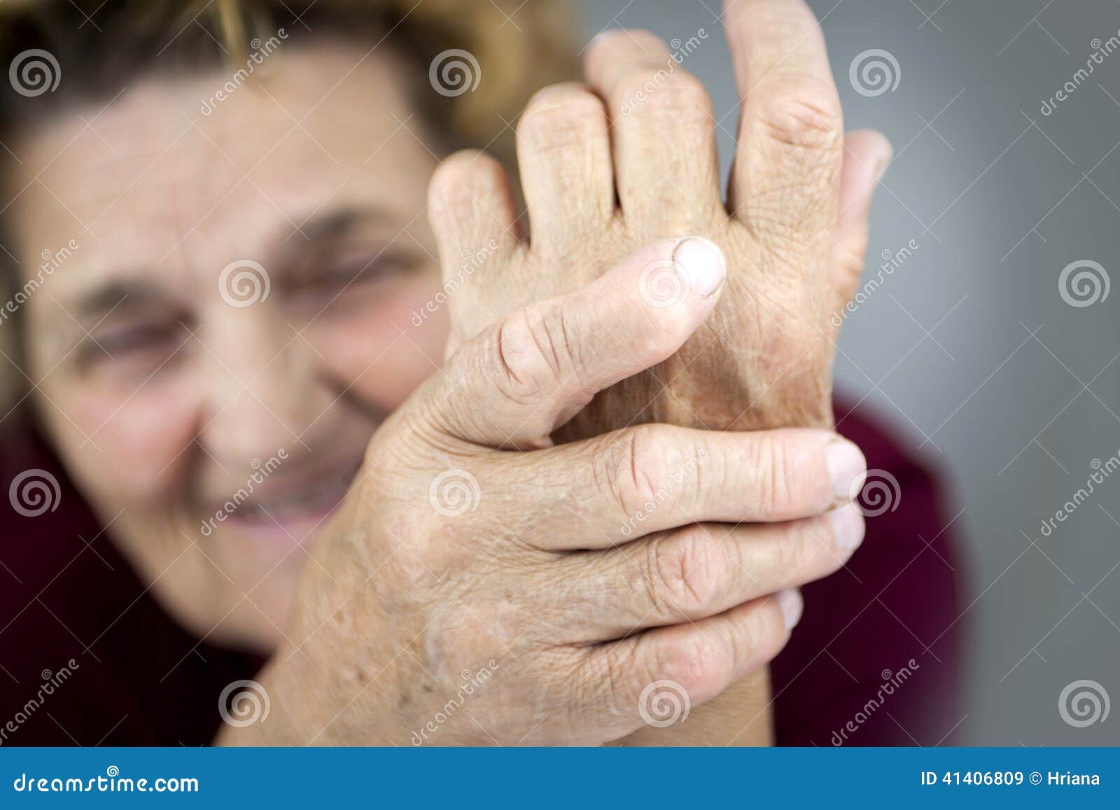 Rheumatoid artrit fotografering för bildbyråer. Bild av kvinna - 41406809