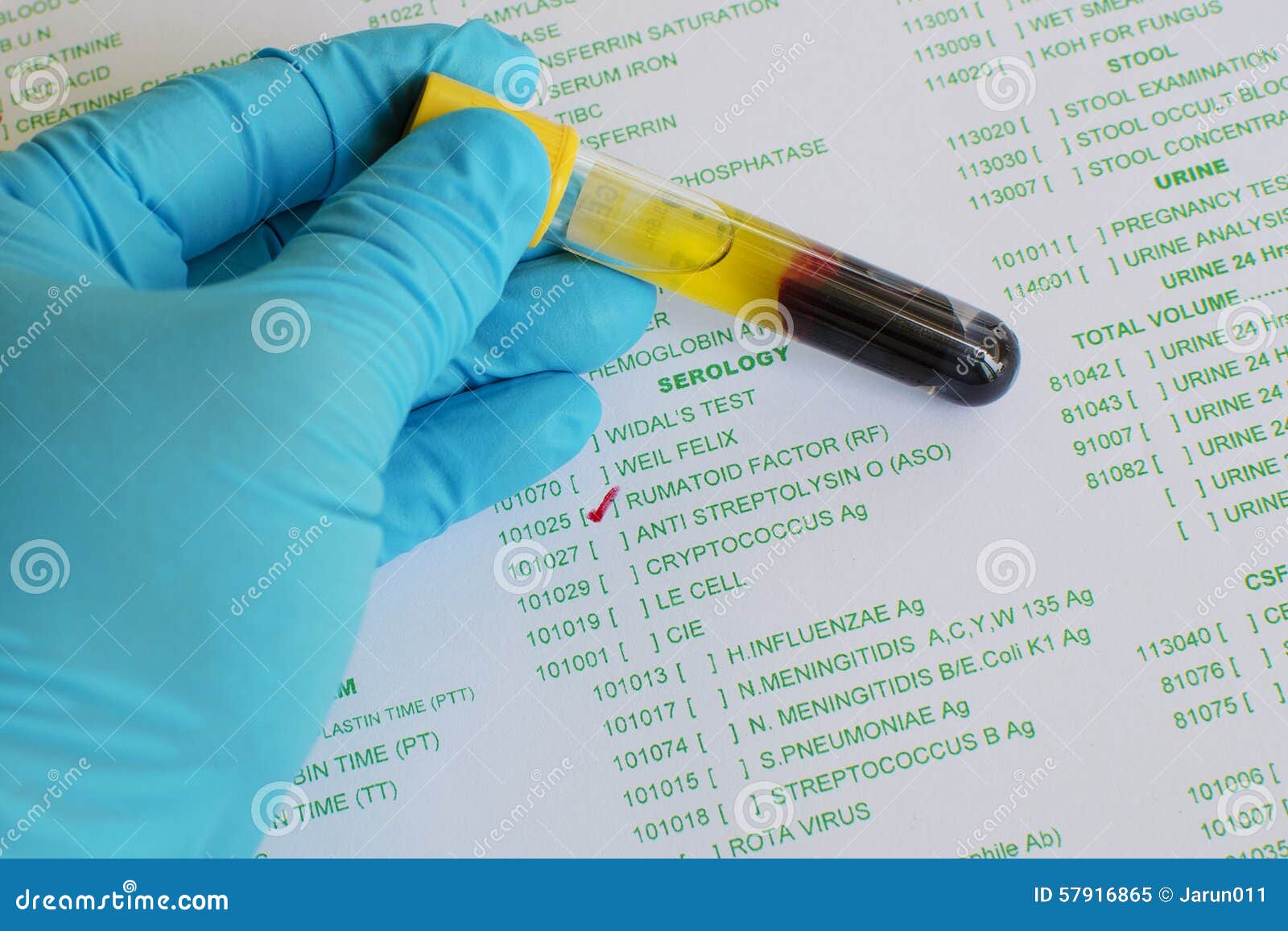 Rheumatoid testing stock image. Image of exam, rheumatoid - 57916865
