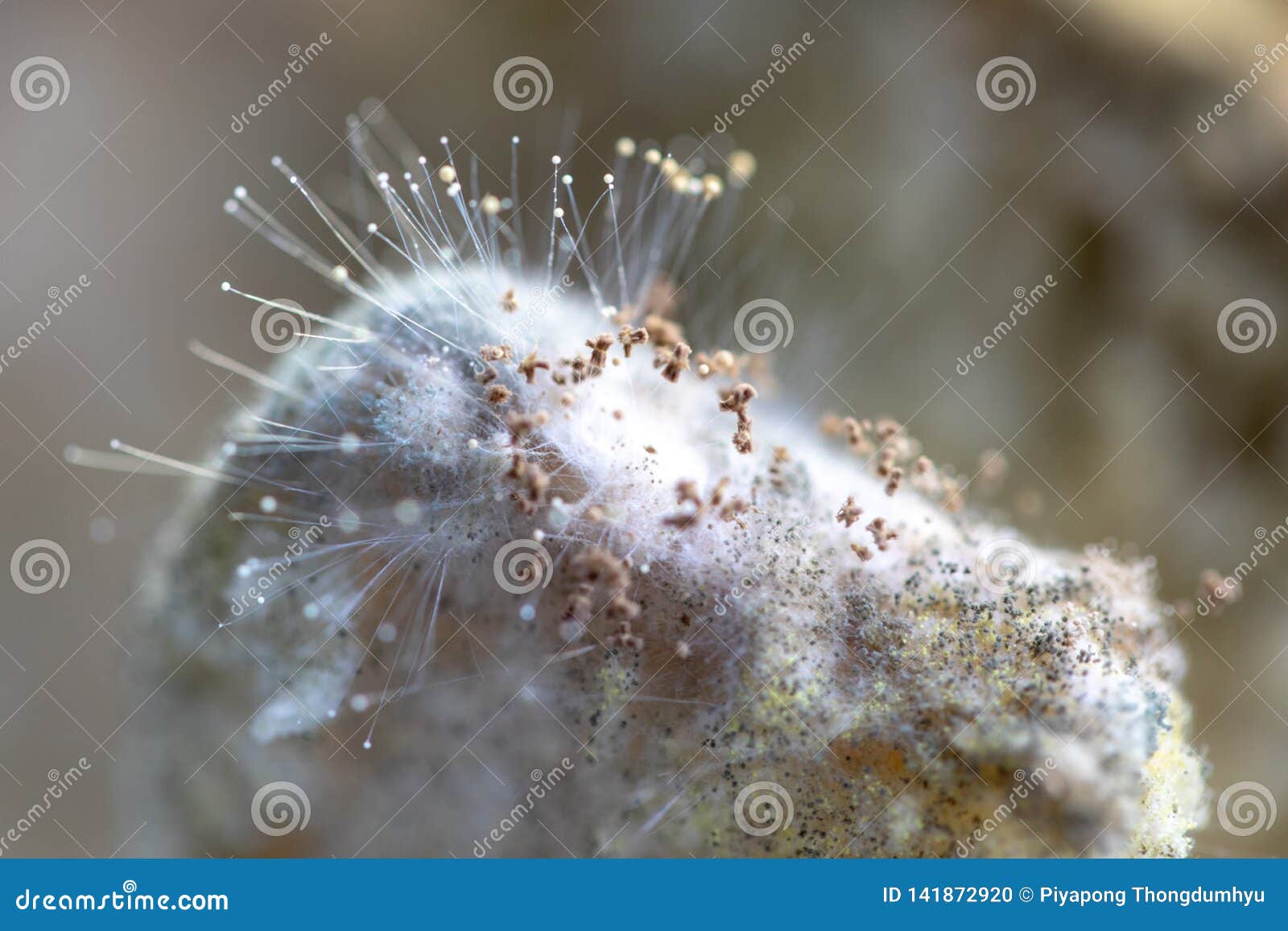 Black Bread Mold Under Microscope