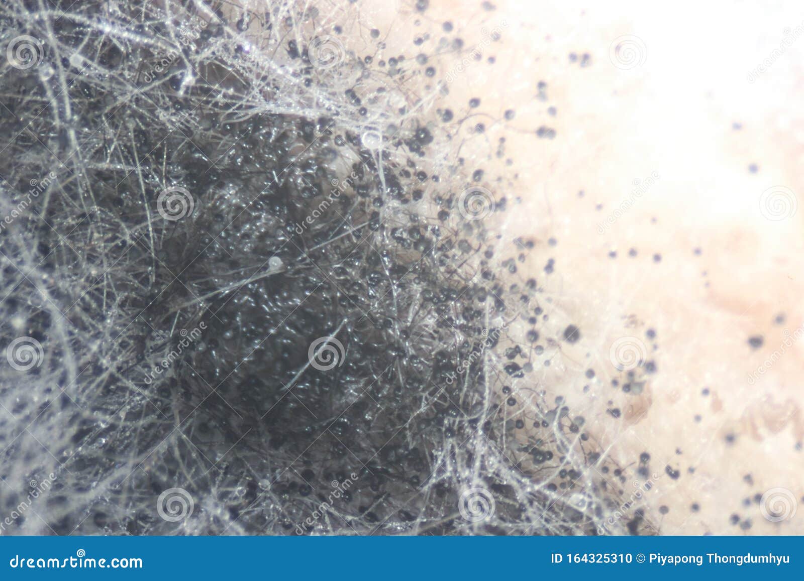 Rhizopus Bread Mold is a Genus of Common Saprophytic Fungi,Rhizopus ...