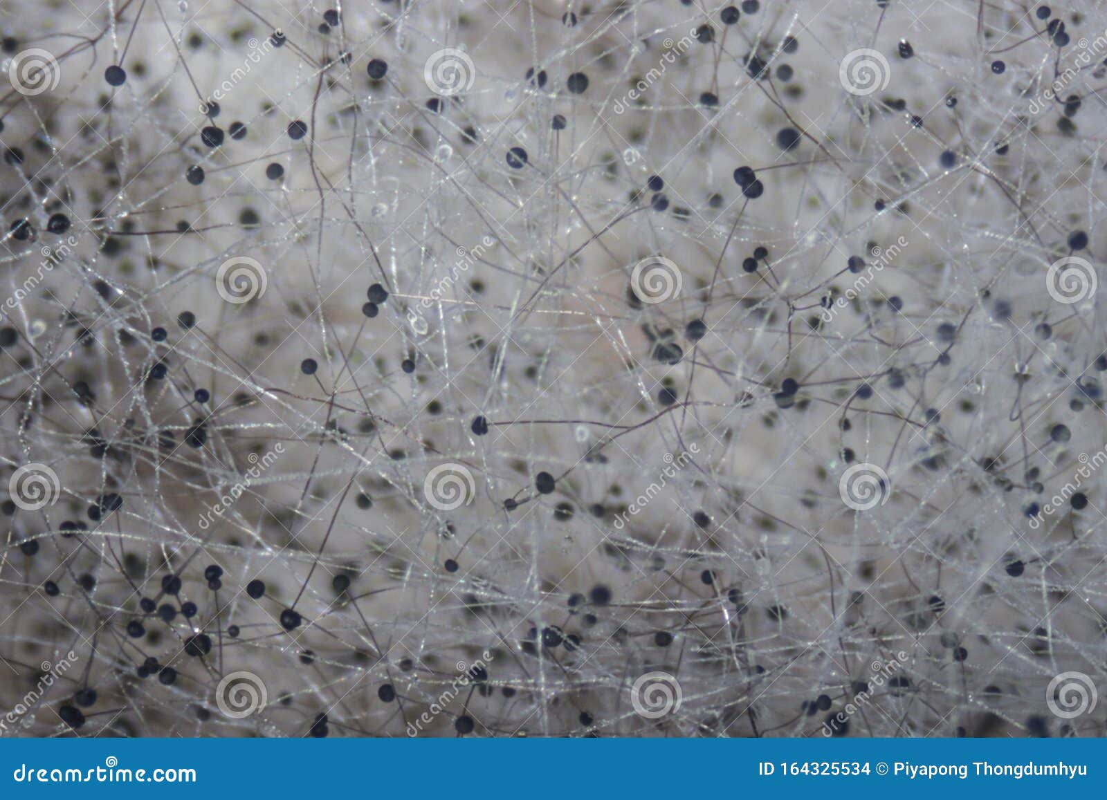 Black Bread Mold Under Microscope