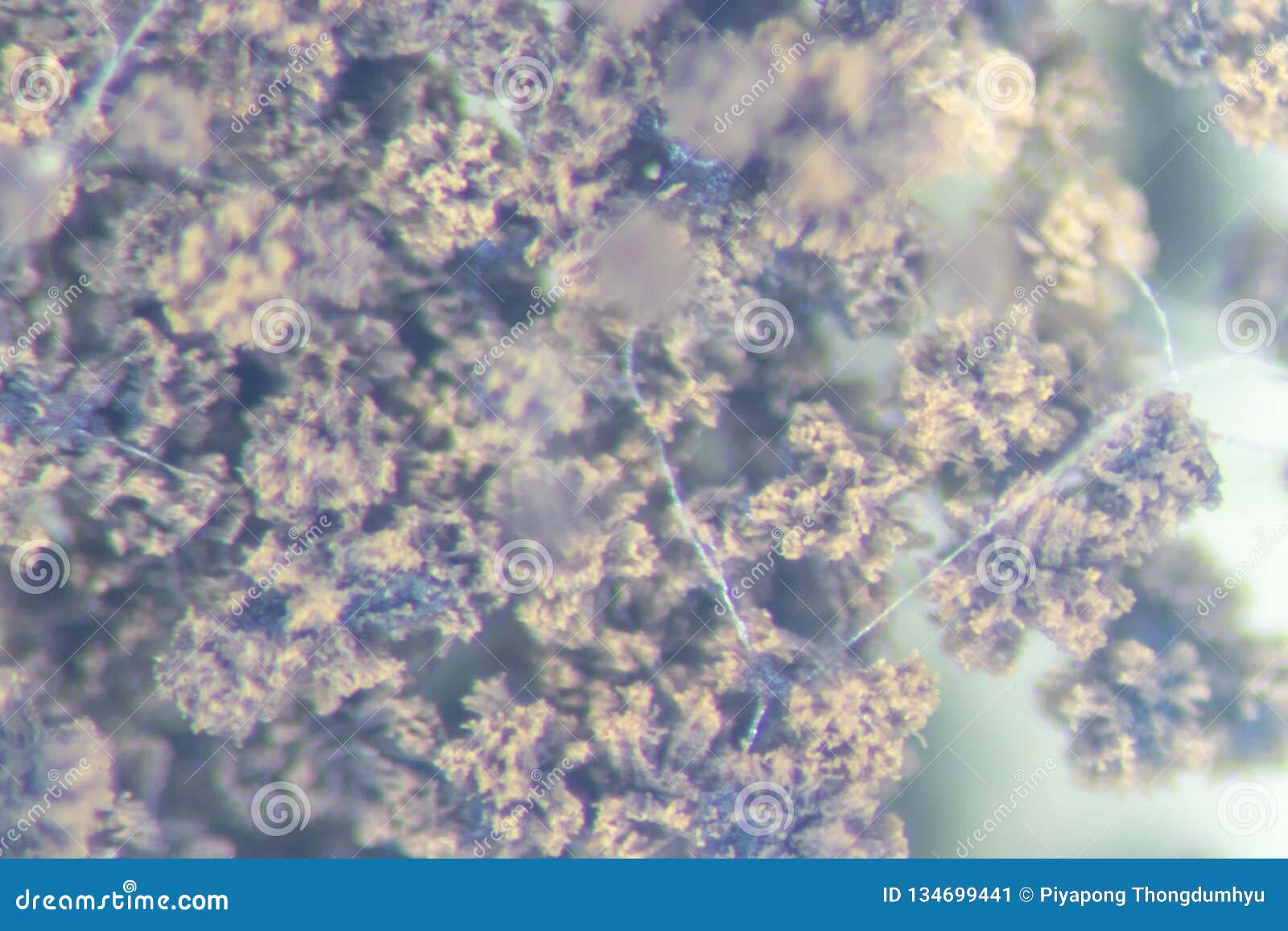 Bread Mold Under Microscope