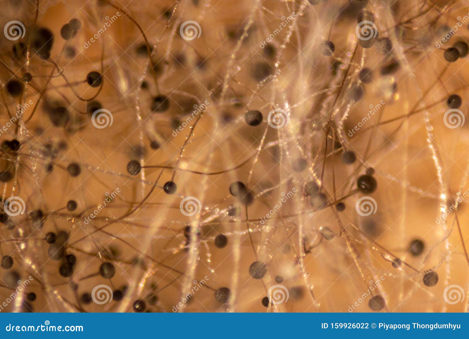 Mold Under Microscope