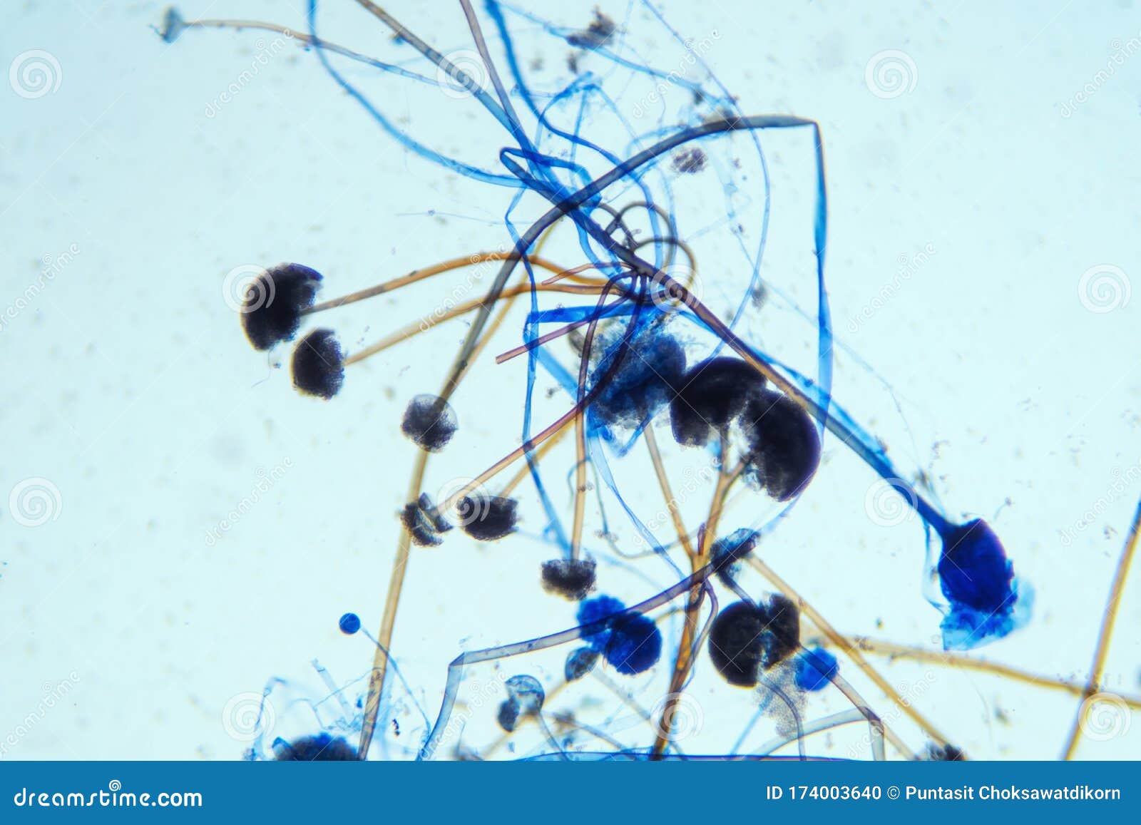 Rhizopus Bread Mold Under the Microscope Stock Photo - Image of biology ...