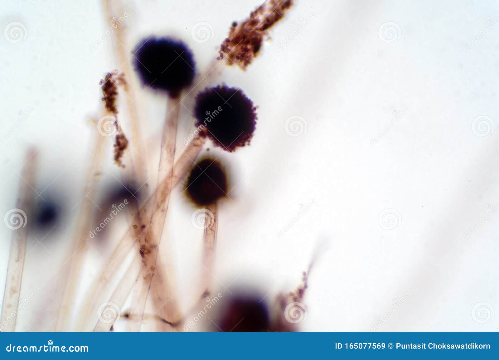 Rhizopus is a Genus of Common Saprophytic Fungi Stock Image - Image of ...
