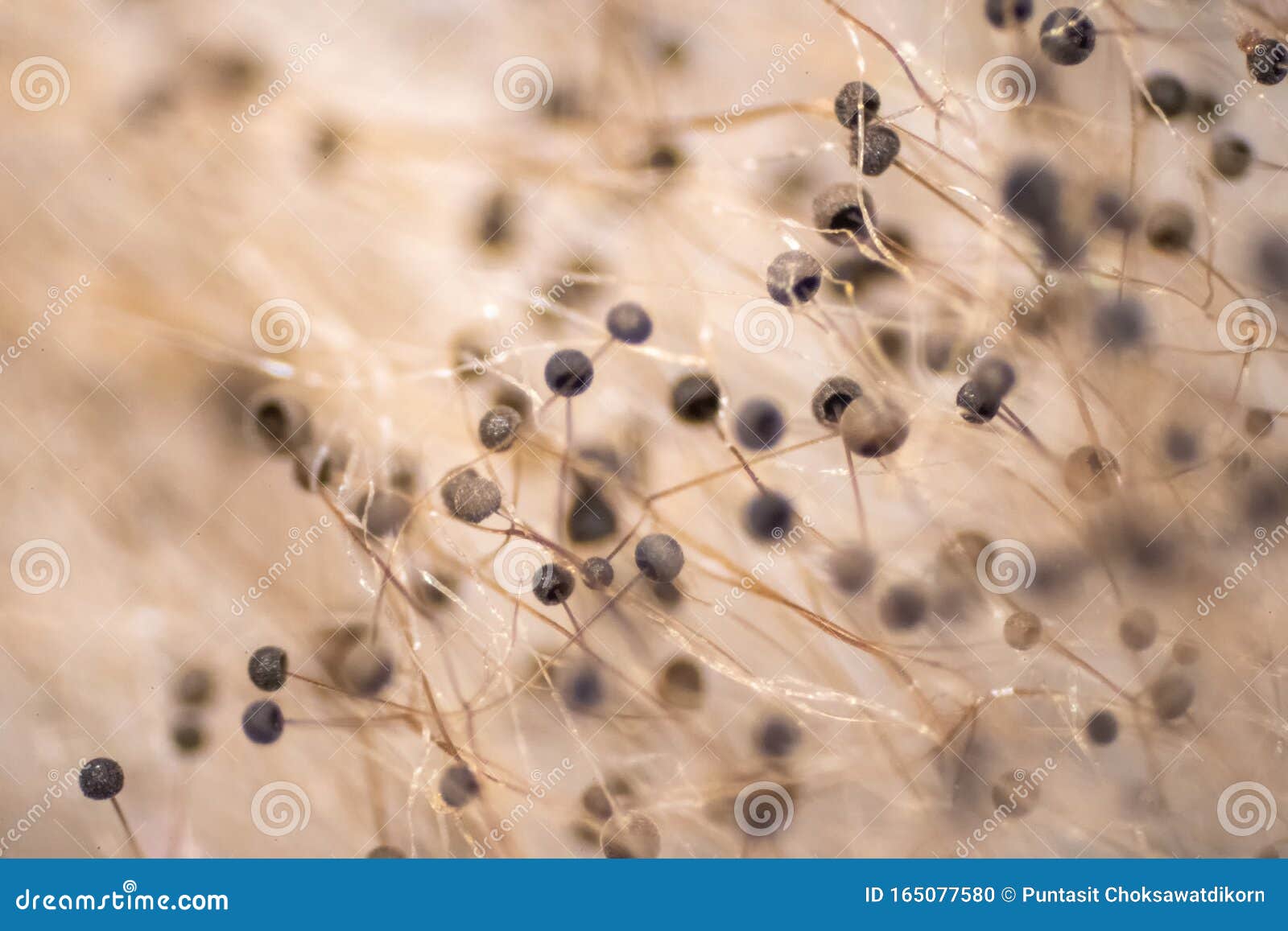 Rhizopus Is A Genus Of Common Saprophytic Fungi On Slide Under The ...