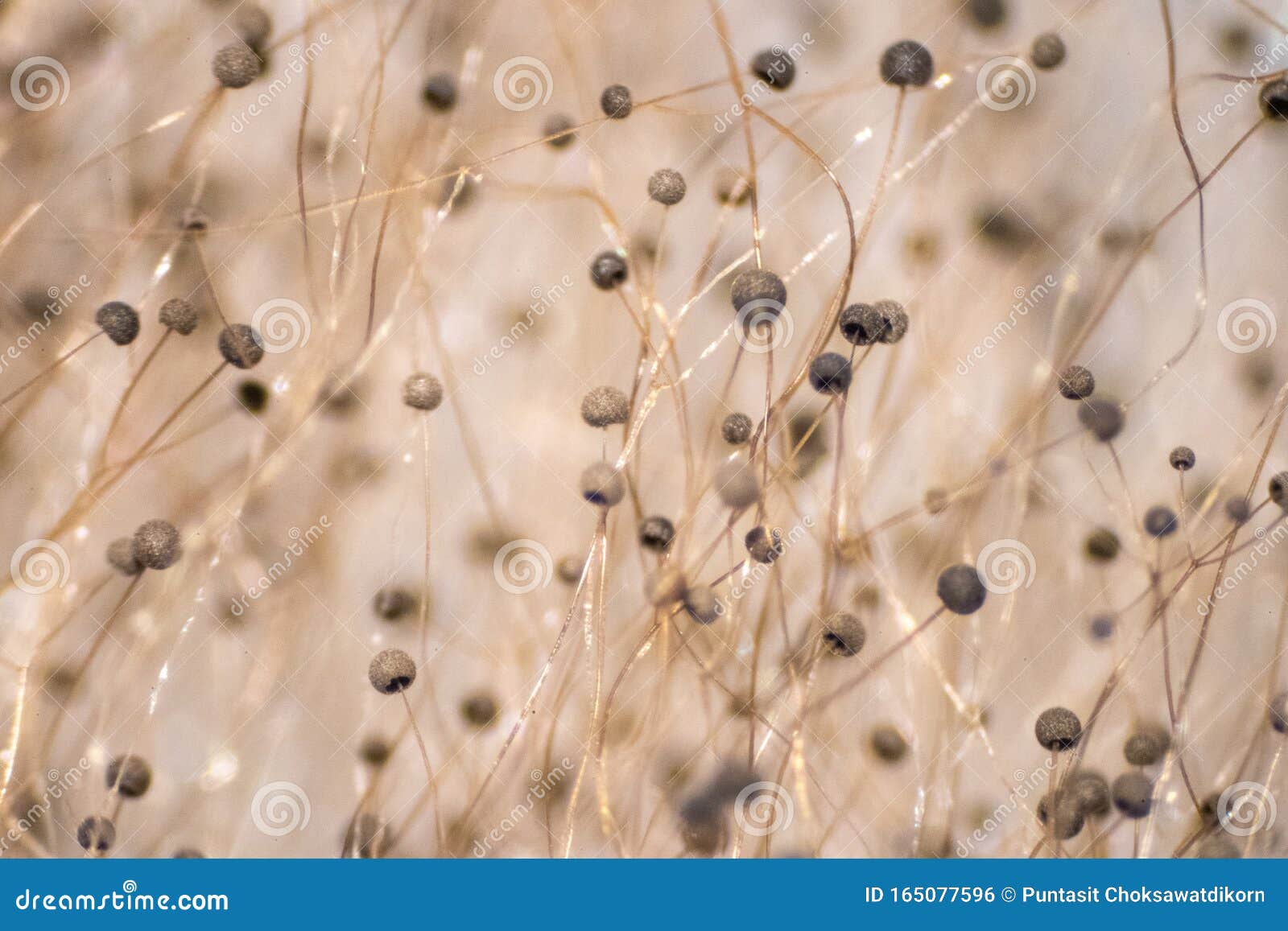 Rhizopus Fungal Hyphae In Tissue Biopsy Specimen Royalty-Free Stock ...