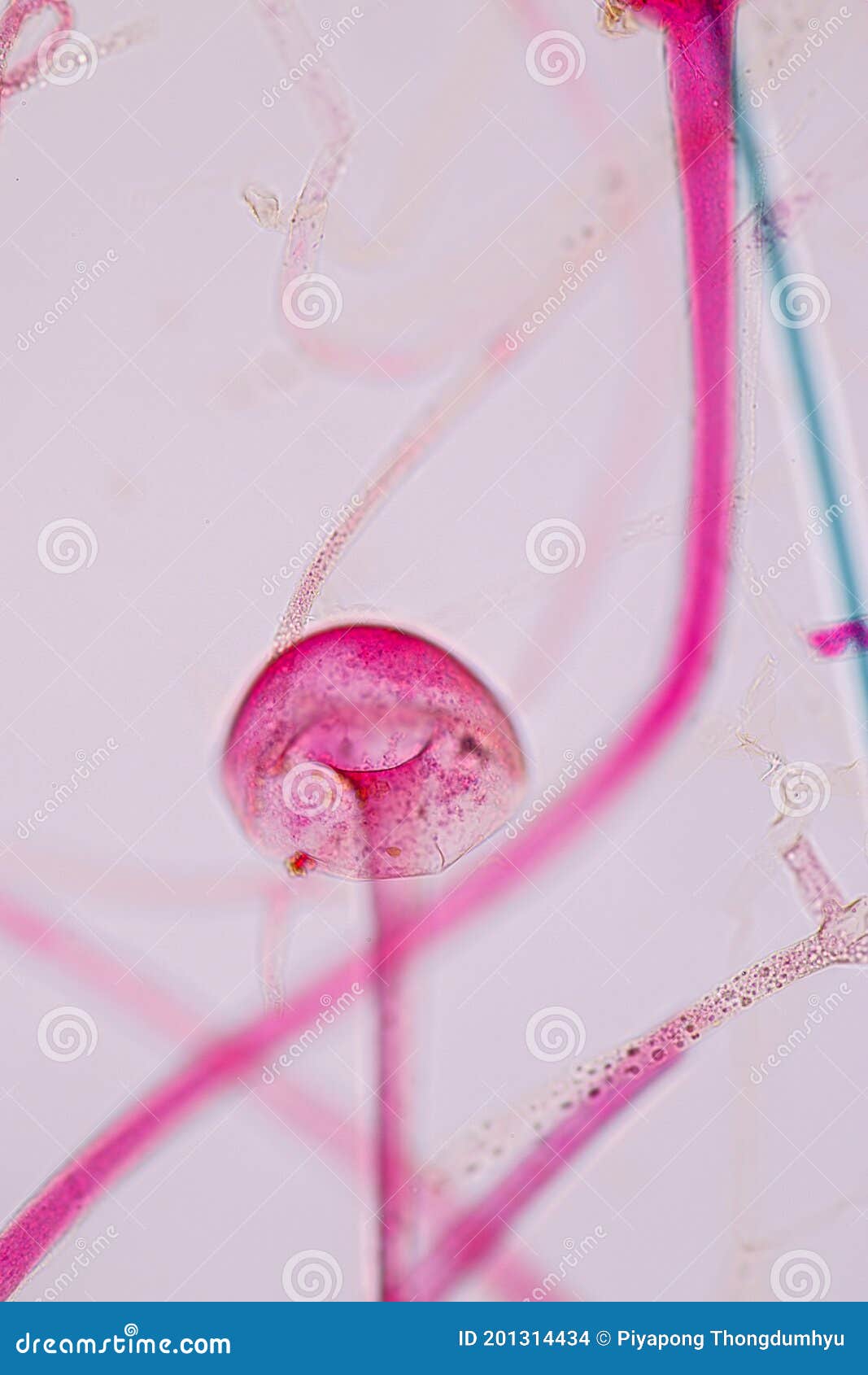 Rhizopus is a Genus of Common Saprophytic Fungi on Slide Under the ...