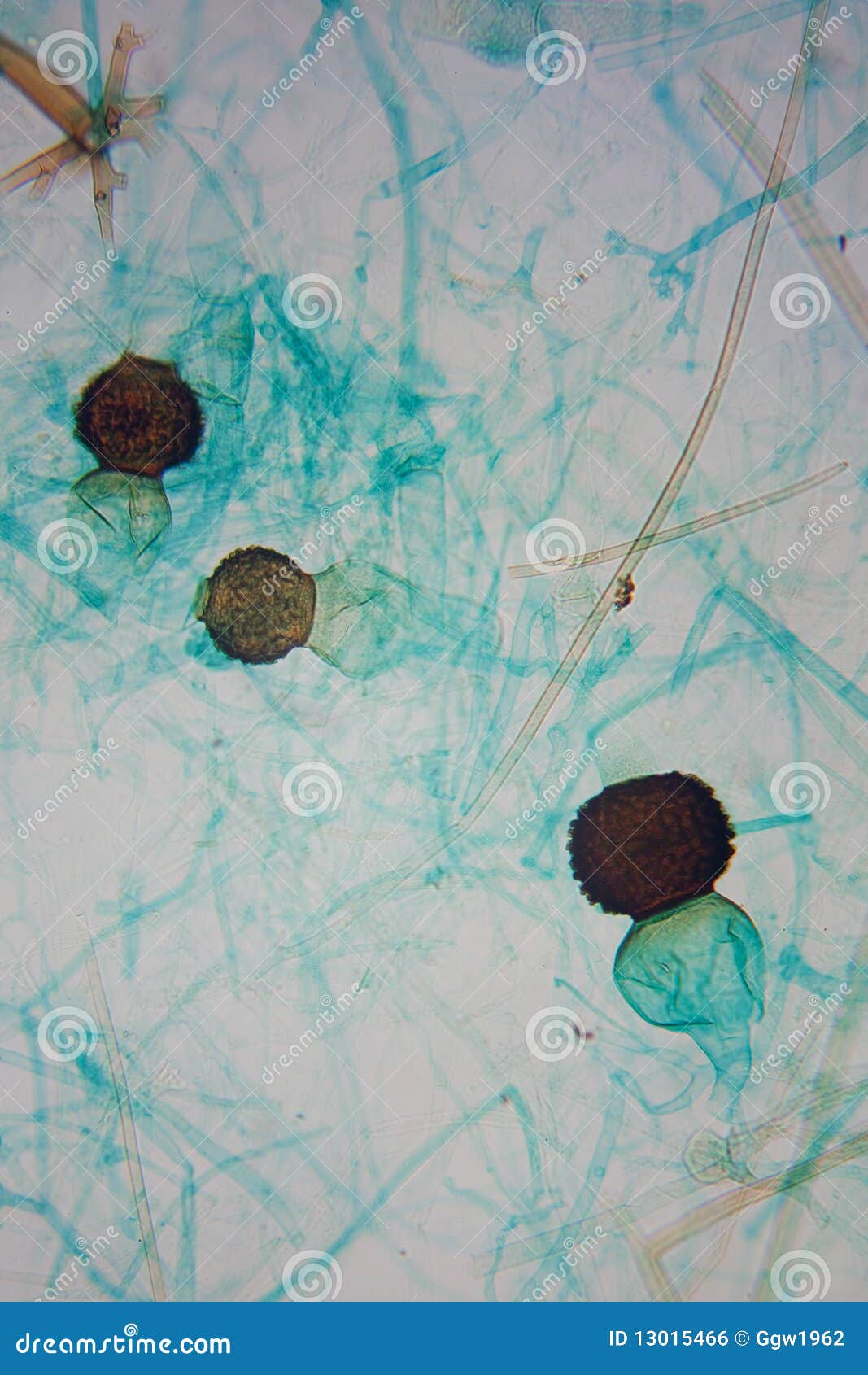 Rhizopus Zygotes stock photo. Image of education, toxin - 13015466