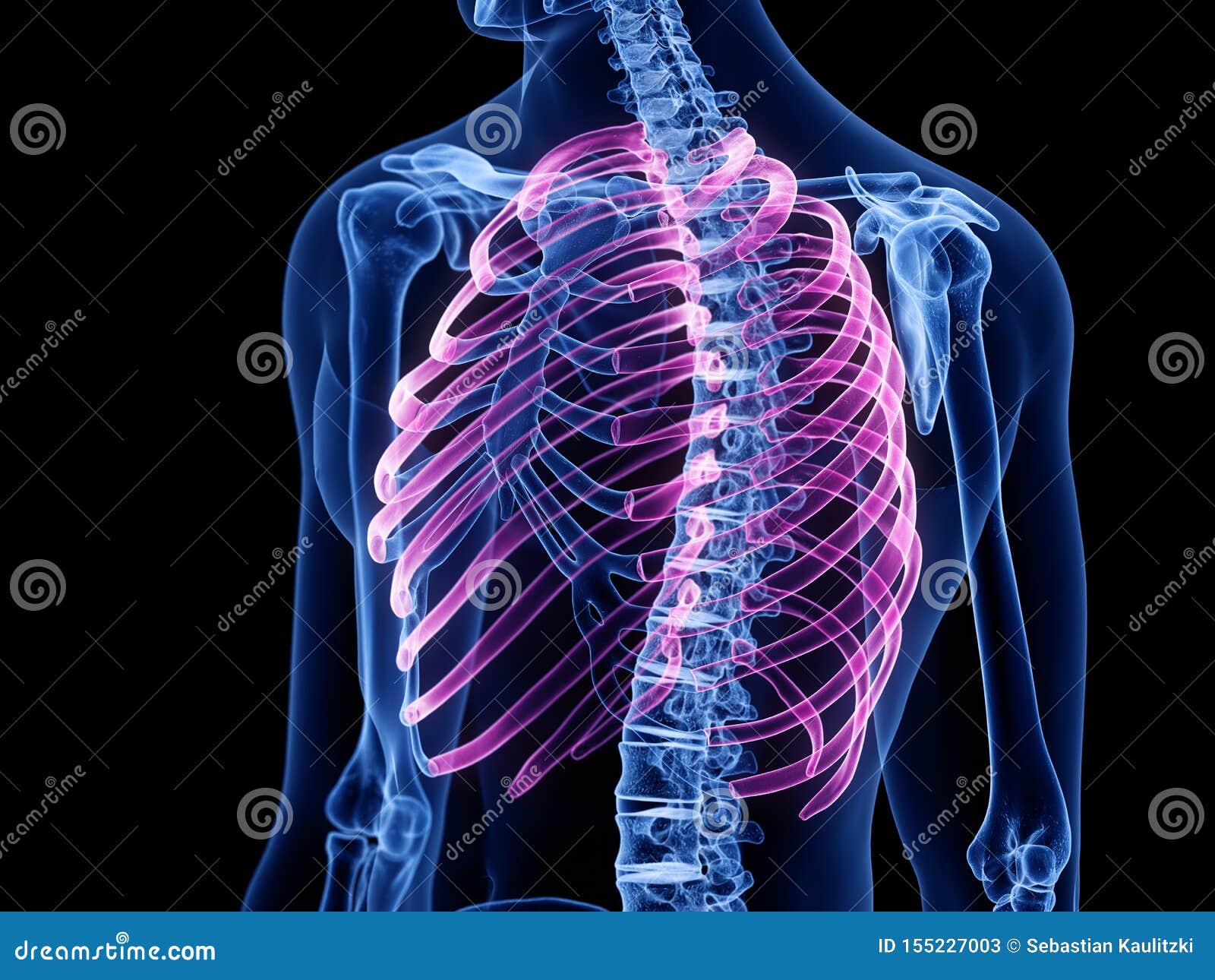 X-ray Illustration. X-ray Ribs Flat Icon On White Background. X-ray ...