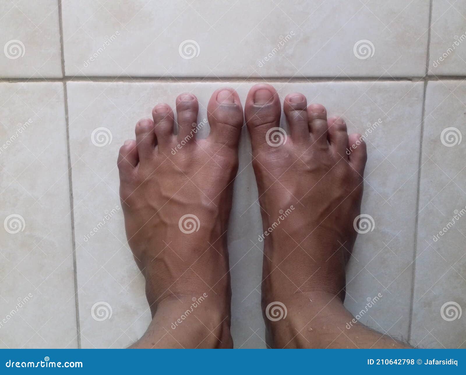 Right foot and left foot stock photo. Image of organ - 210642798