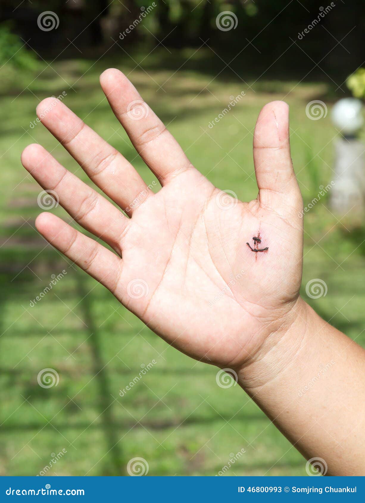 Right hand injury. stock image. Image of nurse, isolated - 46800993