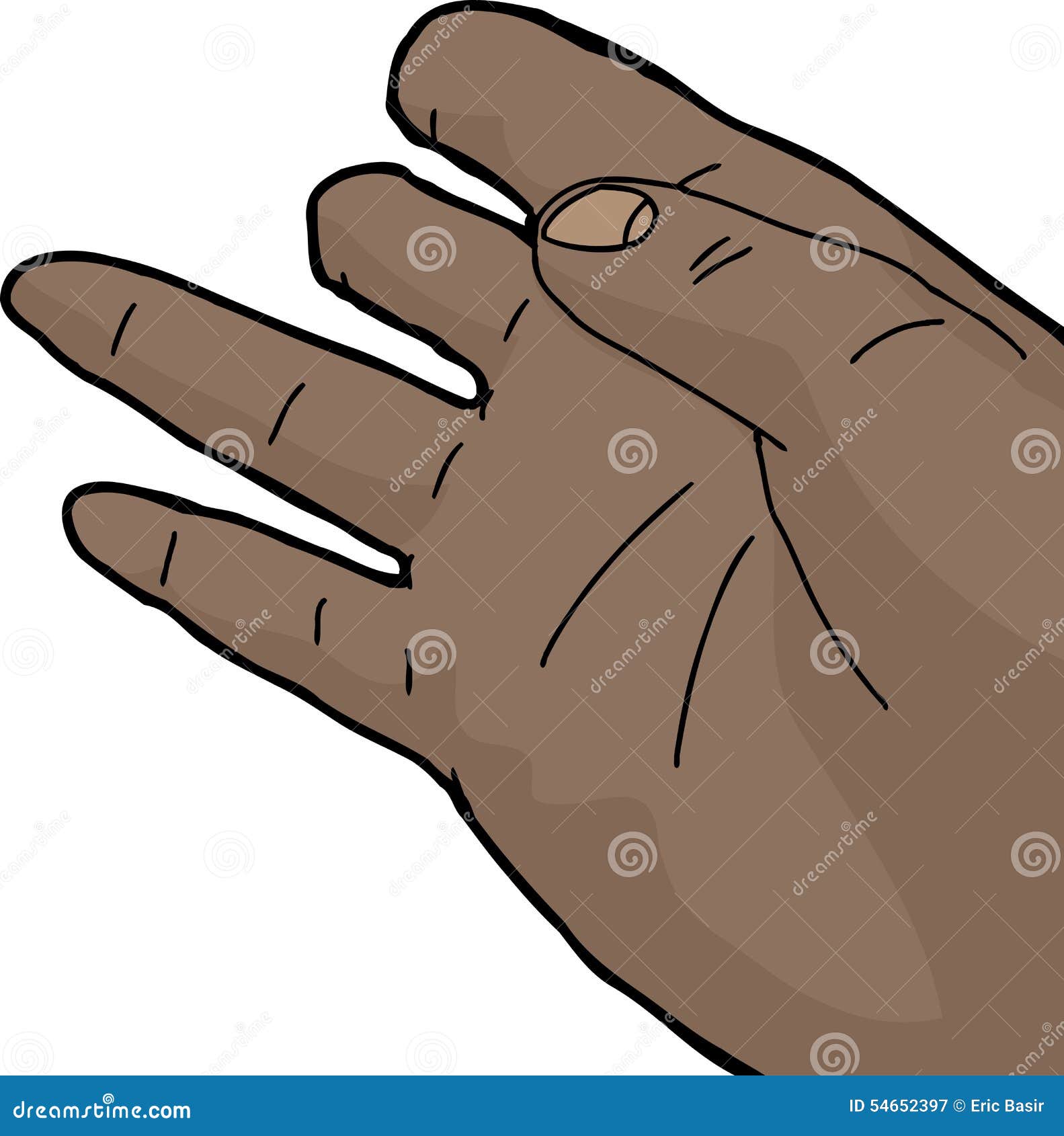 Right Hand with Missing Fingers Stock Illustration - Illustration of ...
