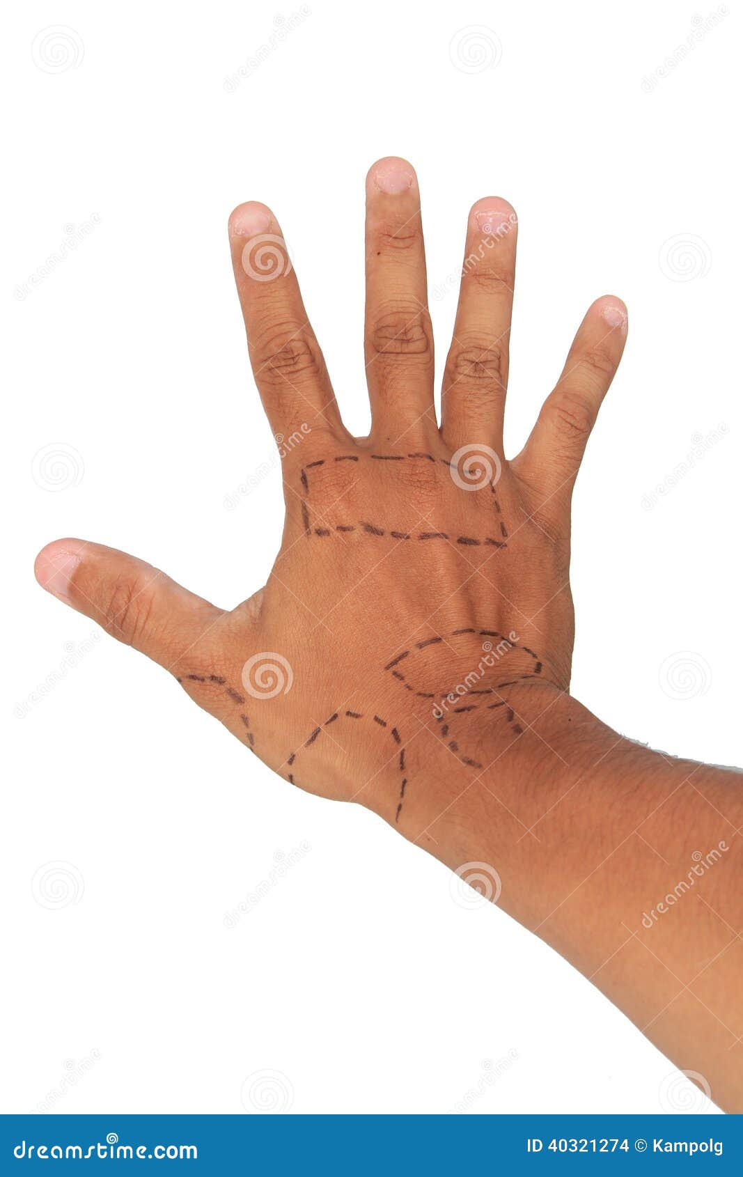 Right Hand Ready for Operation Stock Photo - Image of operation ...