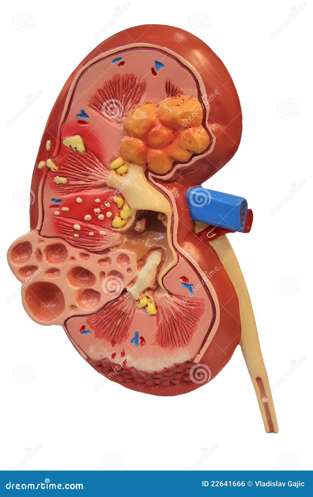 Rim foto de stock. Imagem de medicina, dano, enzima, falha - 22641666