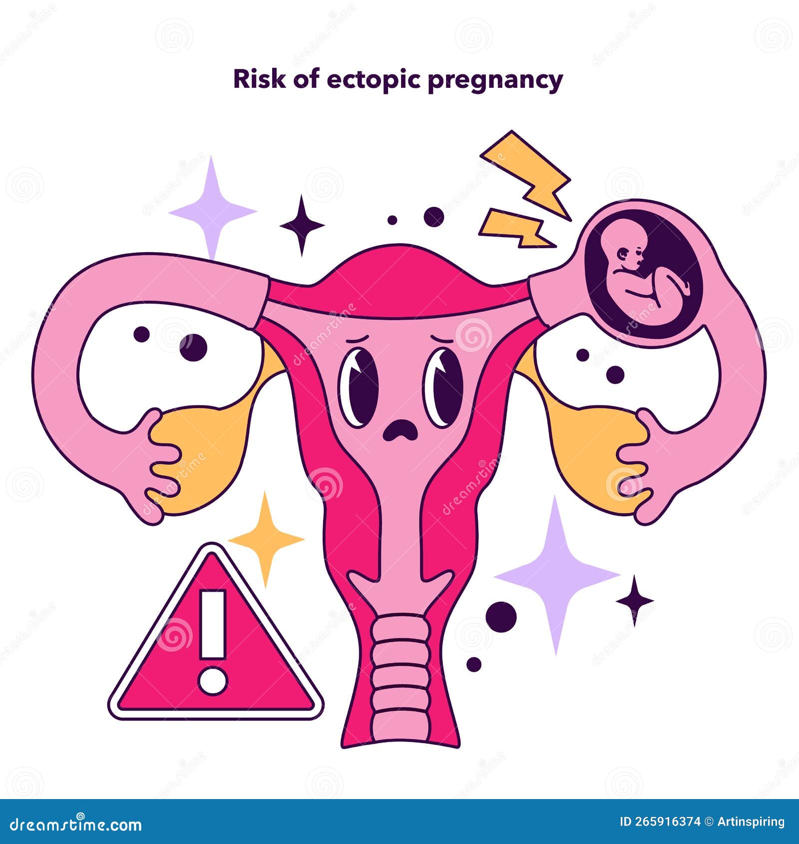 Risk of Ectopic Pregnancy As a Disadvantage of in Vitro Fertilization ...