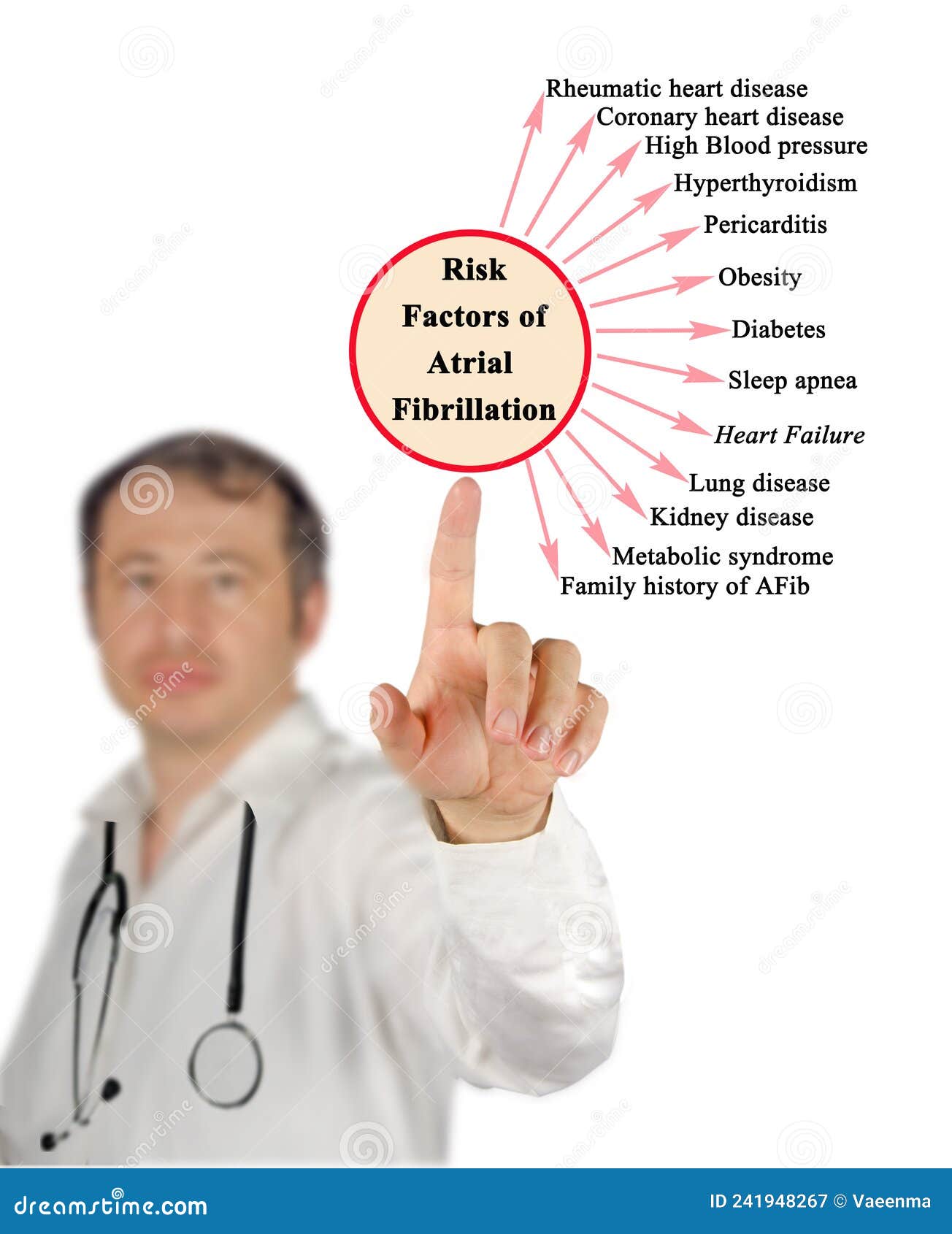 Risk Factors of Atrial Fibrillation Stock Image - Image of factors ...