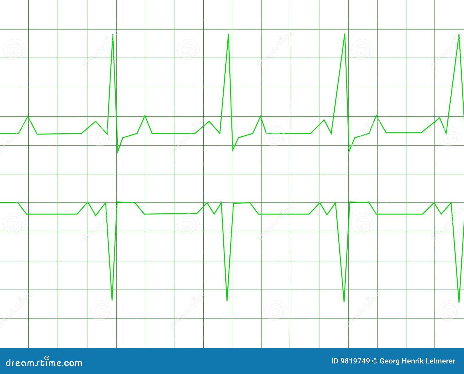 Ritmo normal do coração ilustração stock. Ilustração de monitor - 9819749