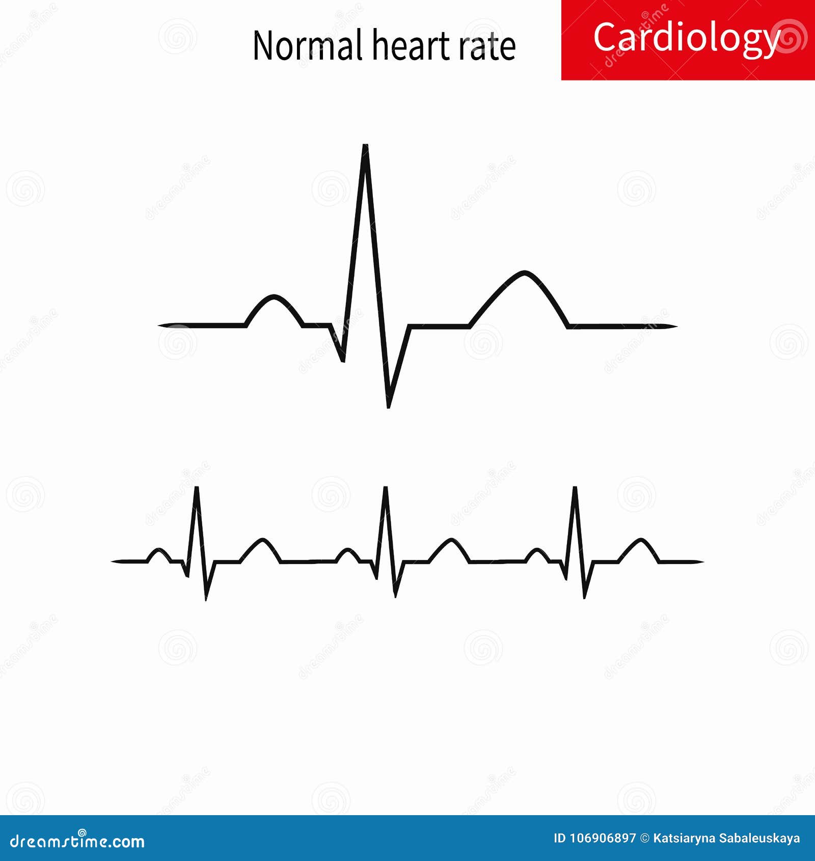 Ritmo Sinusale Complesso E Normale Di ECG Normale Illustrazione di ...
