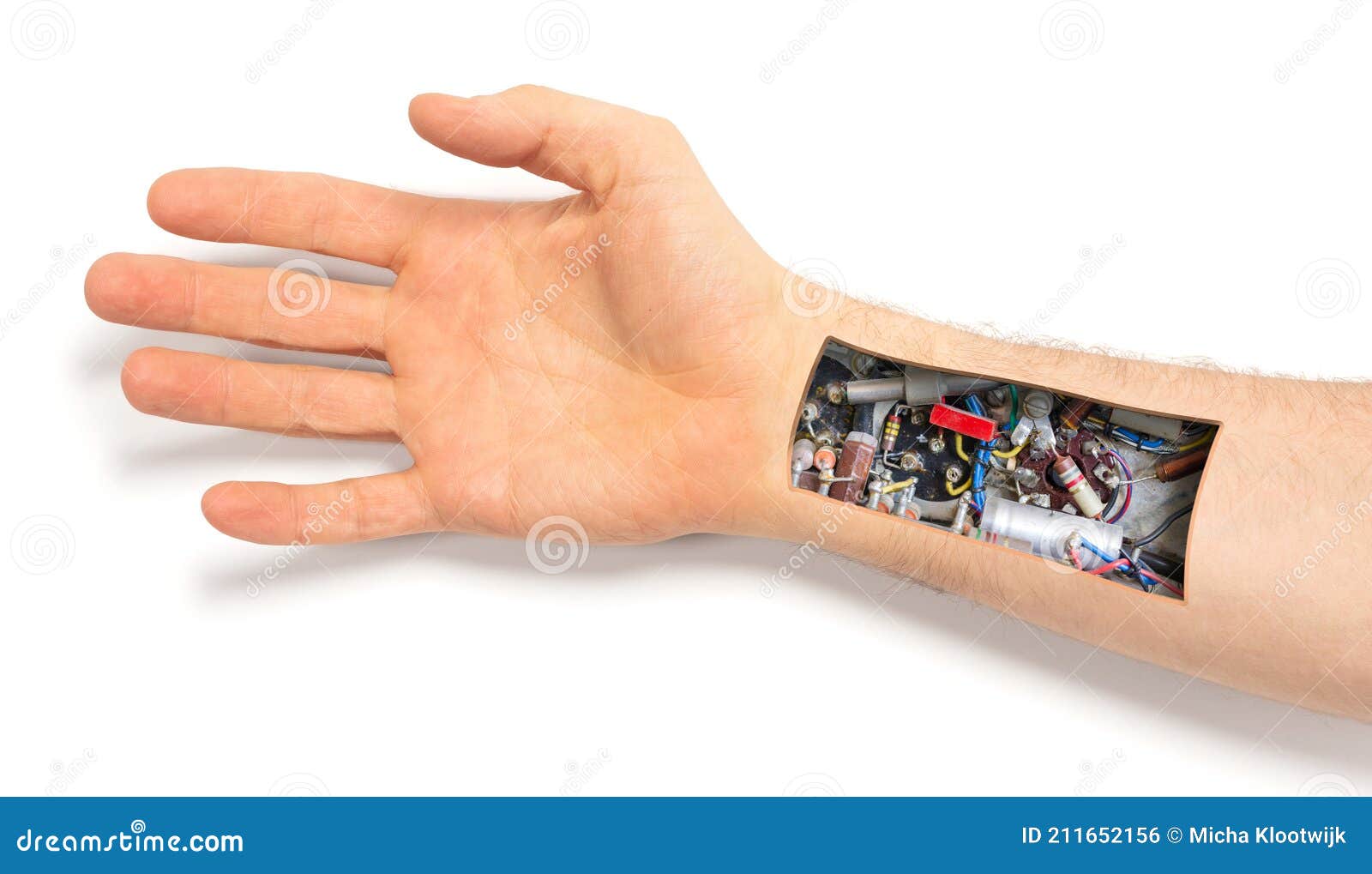 Robot Hand Inside Human Hand - Prosthesis Concept Stock Photo - Image ...