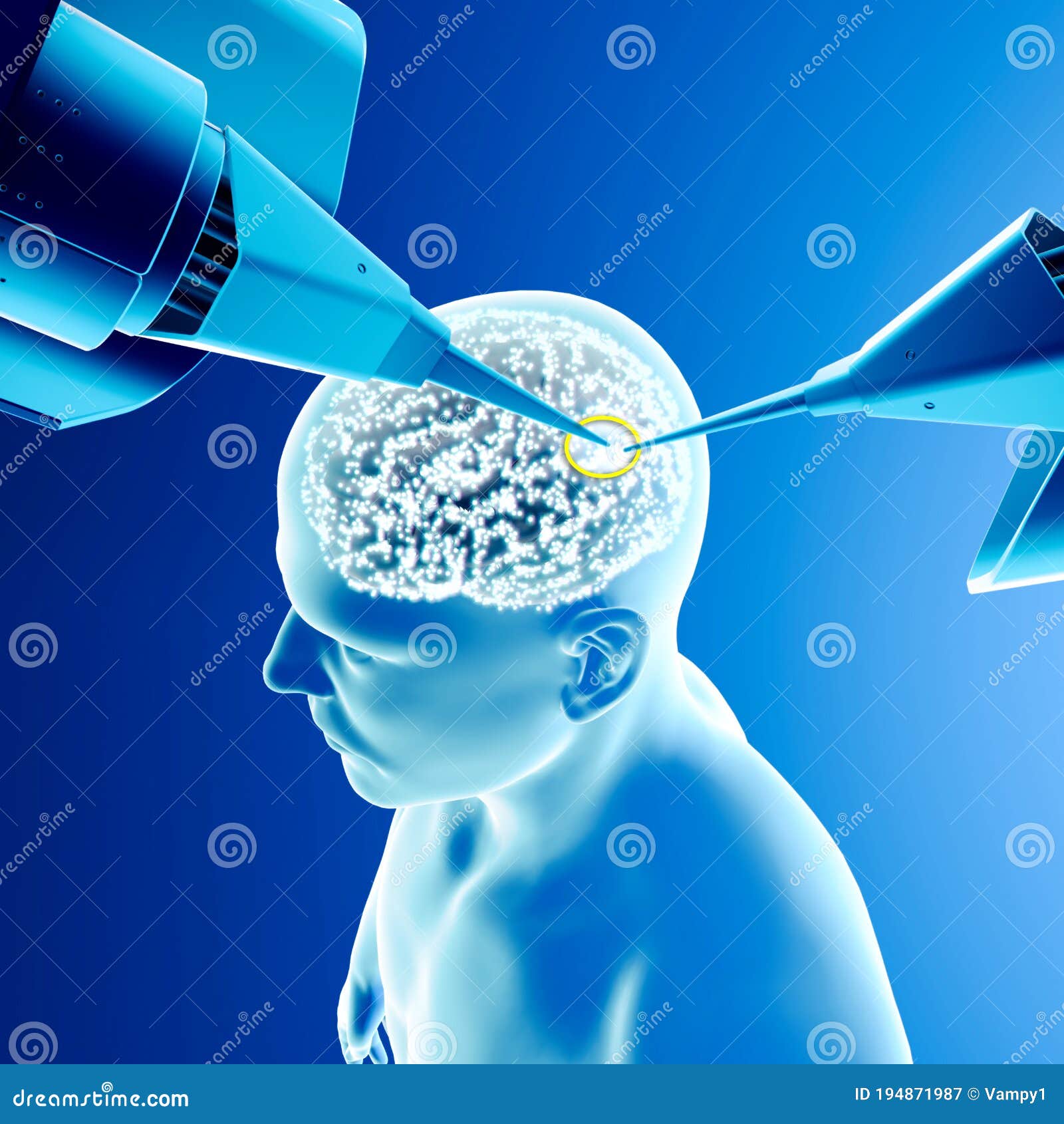 Robotic Brain Operation, Neuron Intervention, New Technology ...