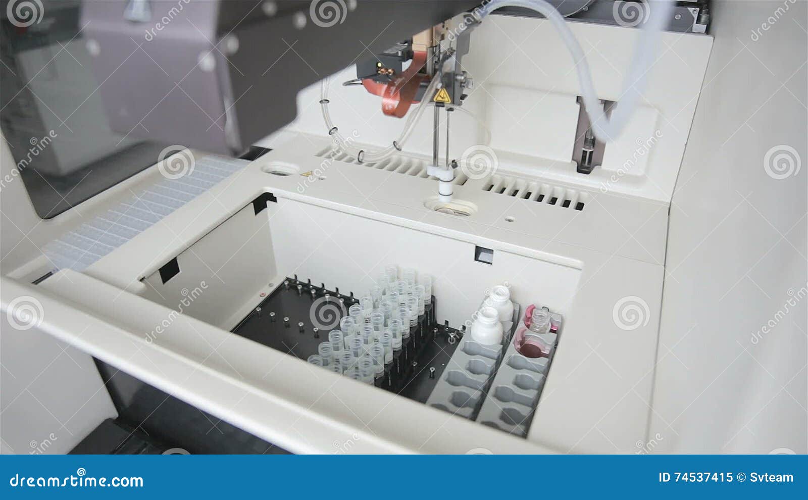 Robotic Laboratory Analysis and Diagnostics of Samples in Test Tubes ...