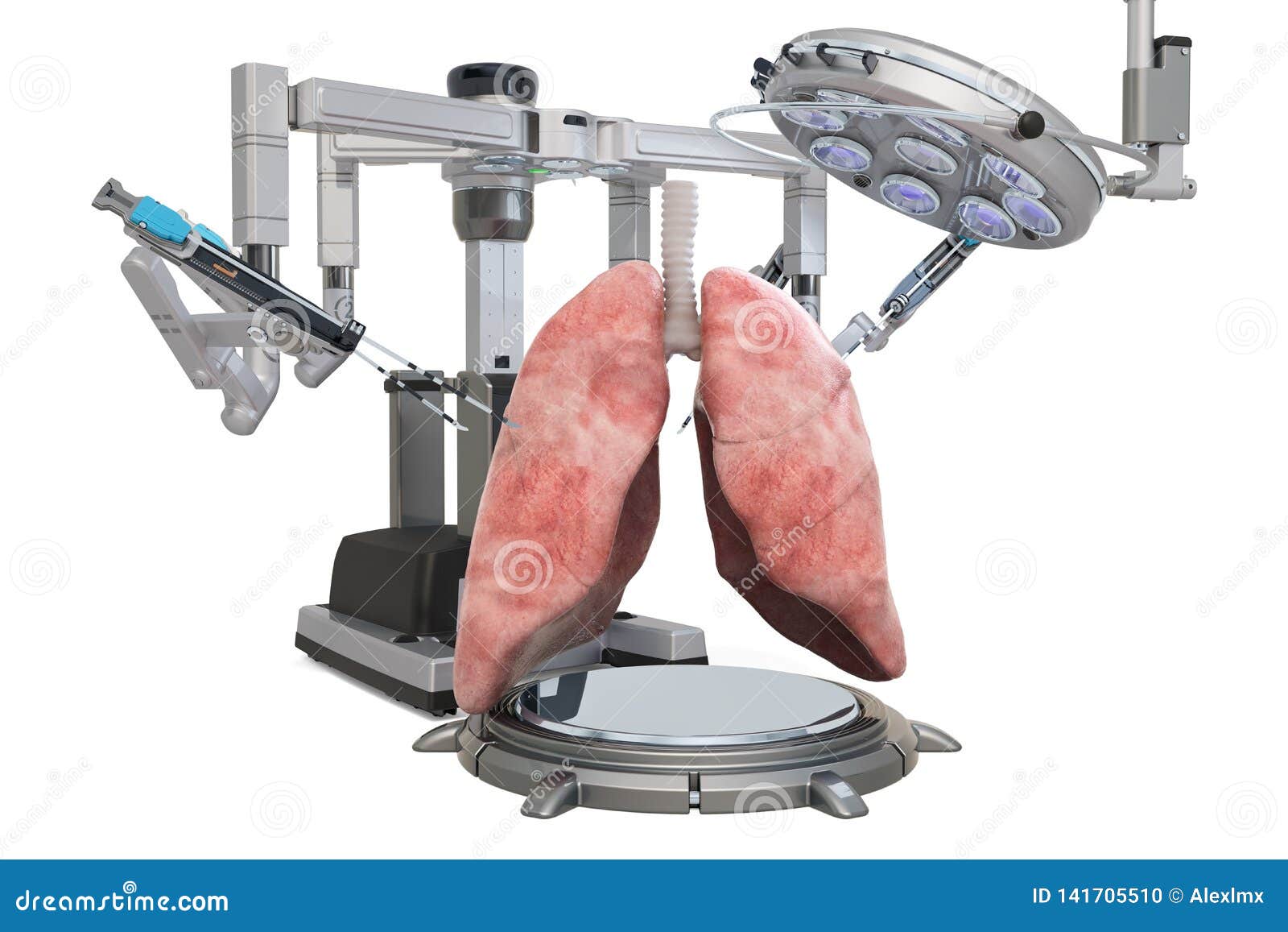 Robotic Surgery of the Lungs Concept, 3D Rendering Stock Illustration ...